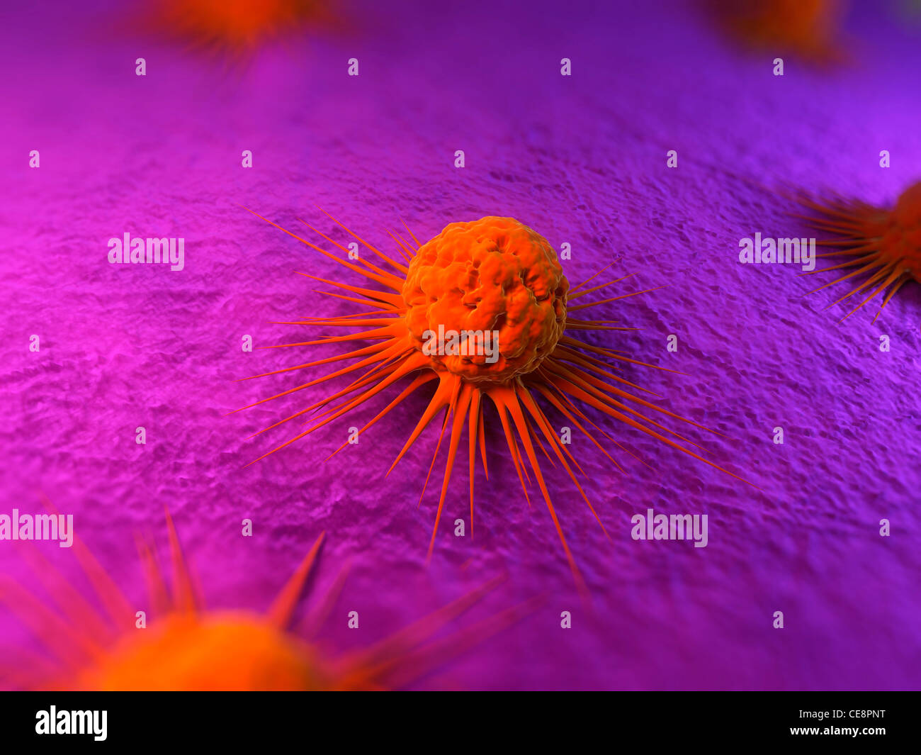 Cancer cells, computer artwork. The uneven surface and cytoplasmic ...