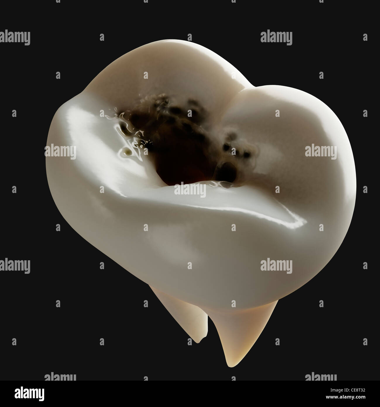 Tooth decay. Computer artwork of a tooth with cavities Stock Photo - Alamy