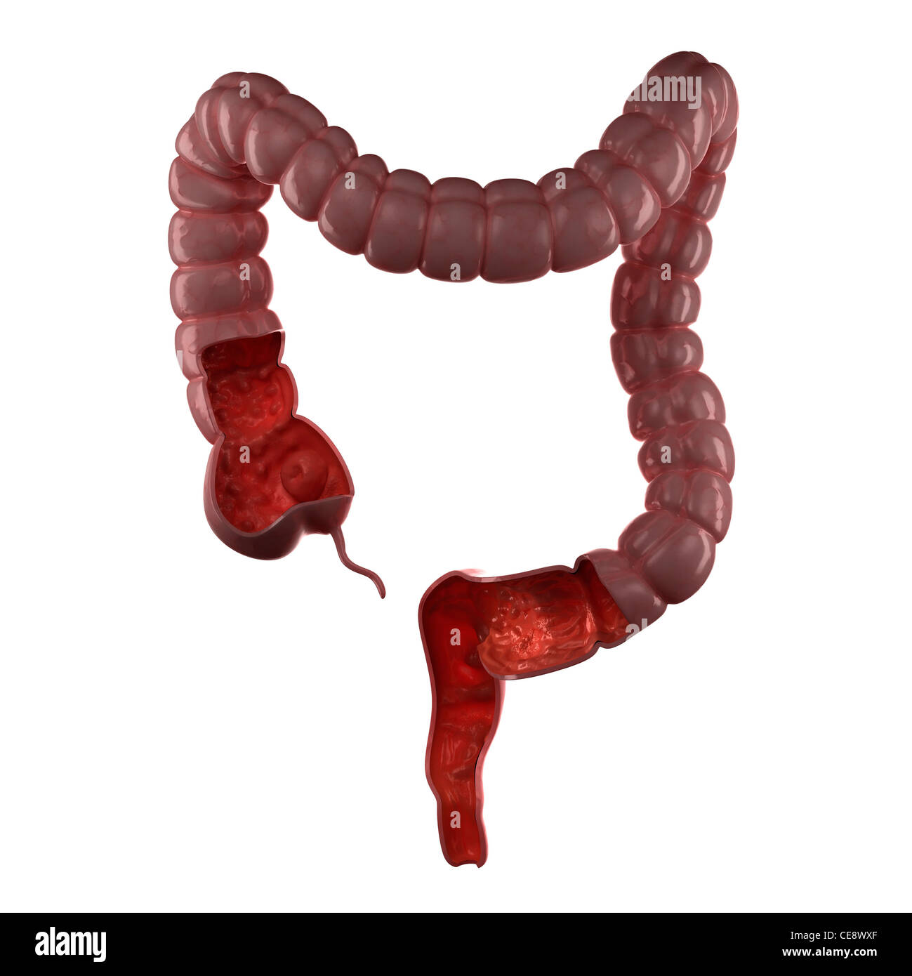 Swollen bodies Cut Out Stock Images & Pictures - Alamy