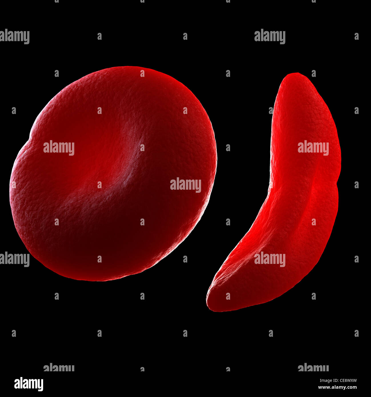 Sickle cell anaemia, computer artwork Stock Photo - Alamy