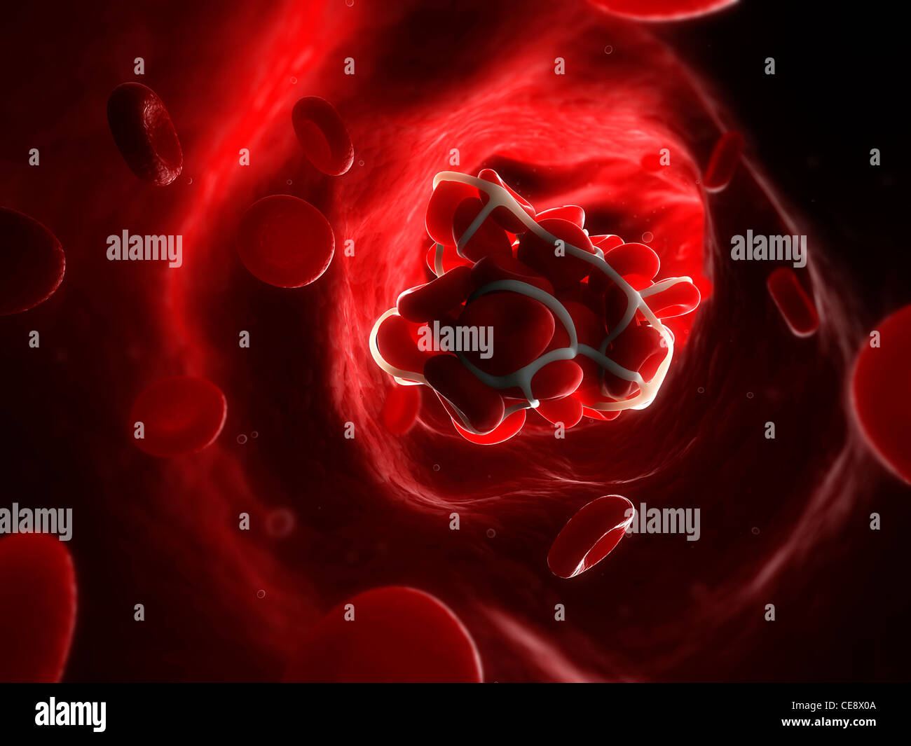 Blood clot. Computer artwork of red blood cells trapped in a fibrin ...