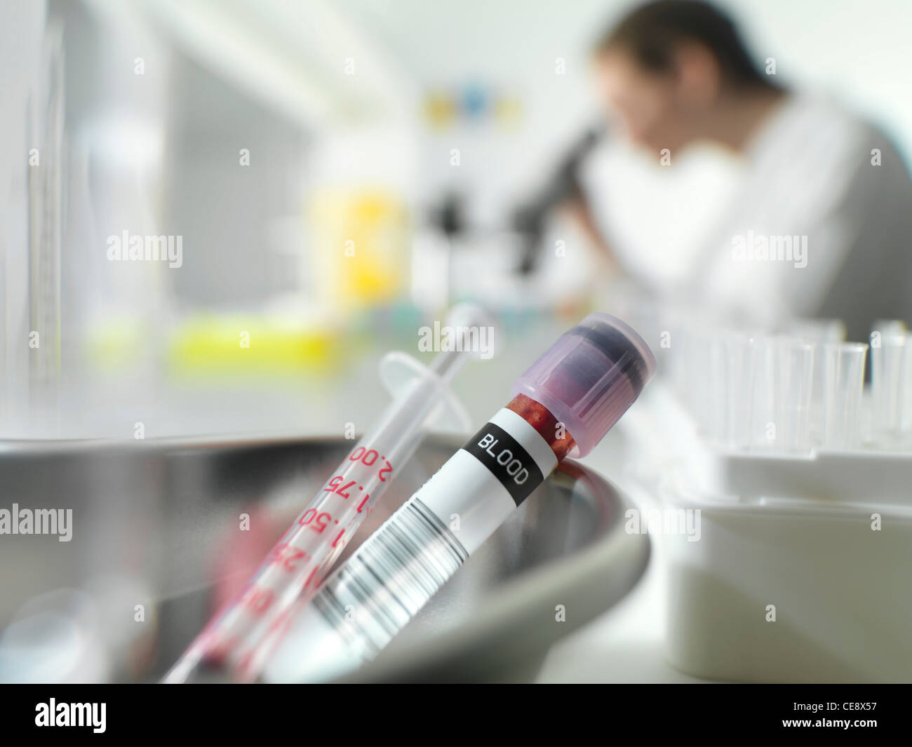 MODEL RELEASED. Haematology lab Stock Photo - Alamy