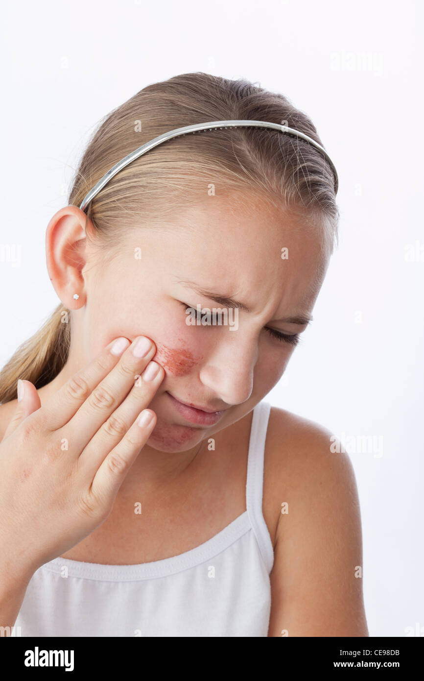 Childhood scar hi-res stock photography and images - Alamy