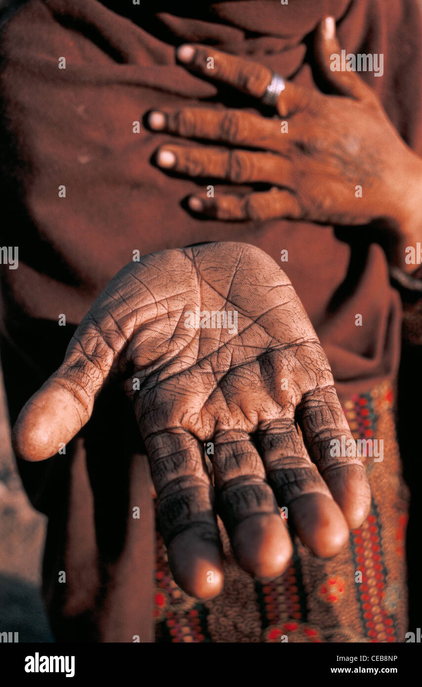 Very poor woman showing her hand ( India Stock Photo - Alamy