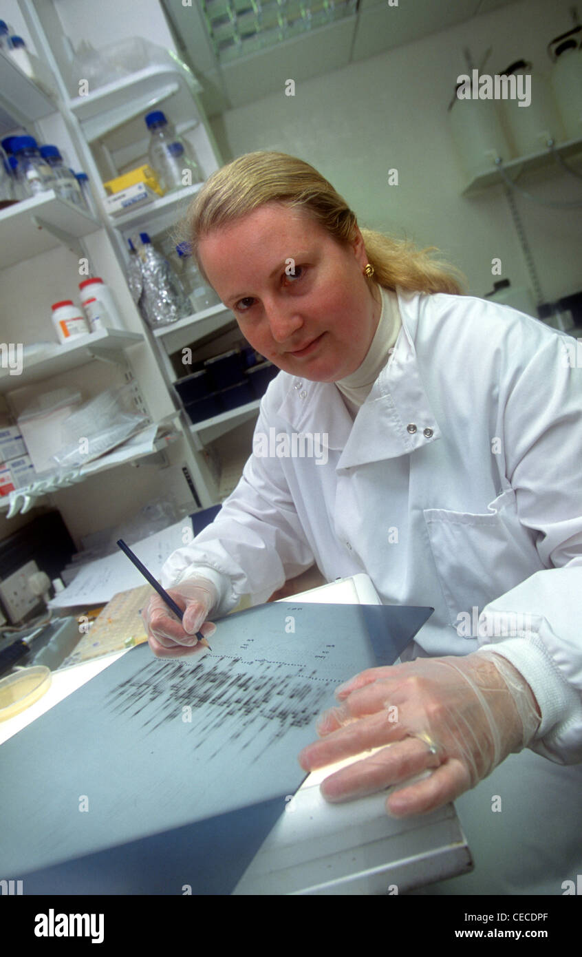 Dr Marcella Votruba who discovered the cause of Dominant Optic Atrophy ...