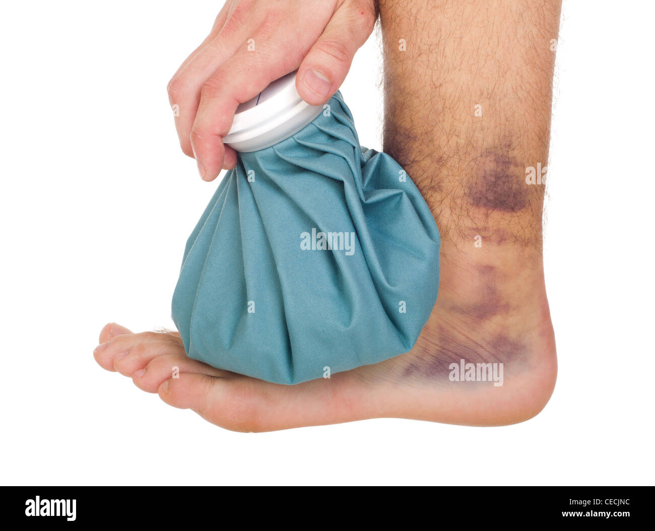 Man with sprained ankle Stock Photo - Alamy