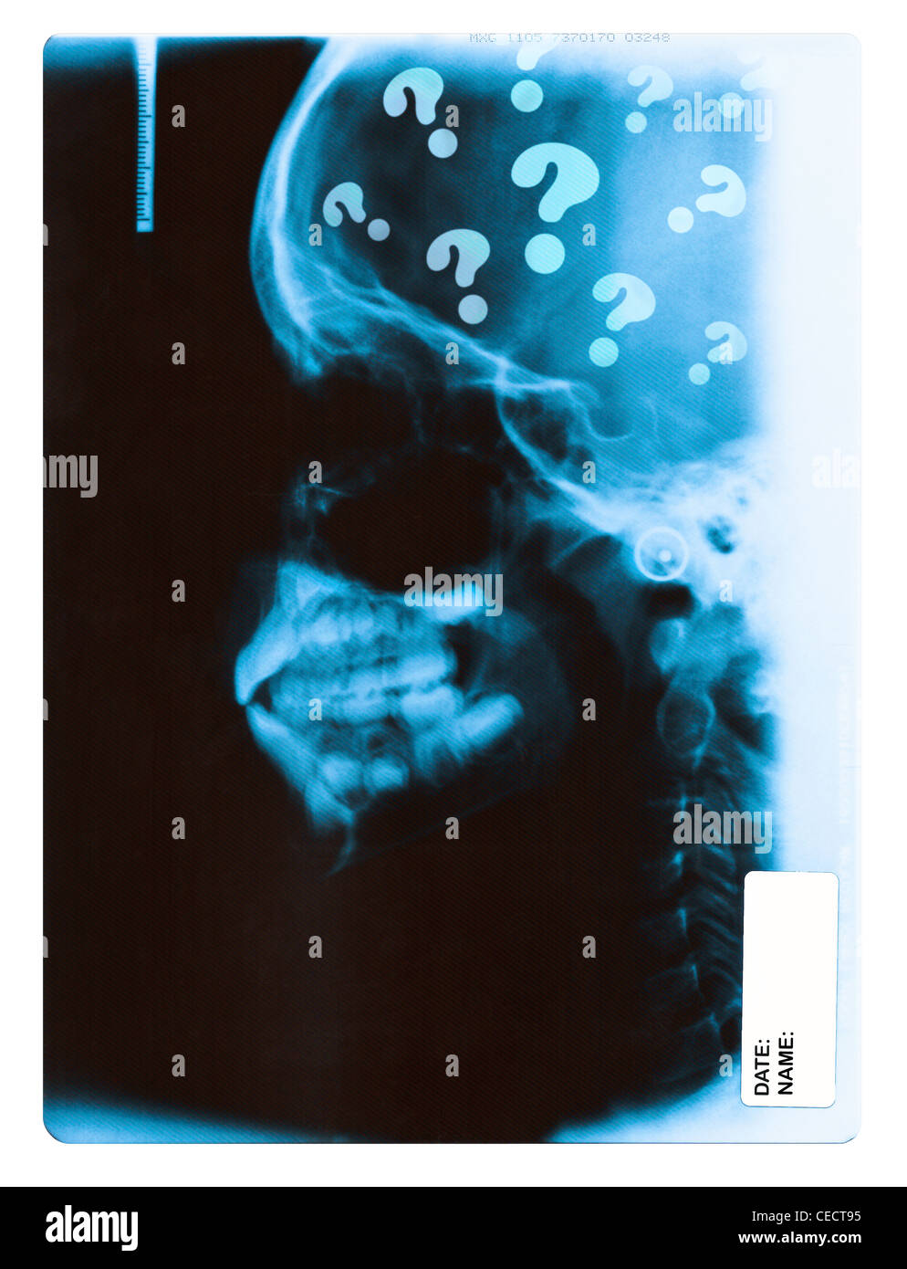 X-ray image of a child skull full of questions and ideas, isolated on ...