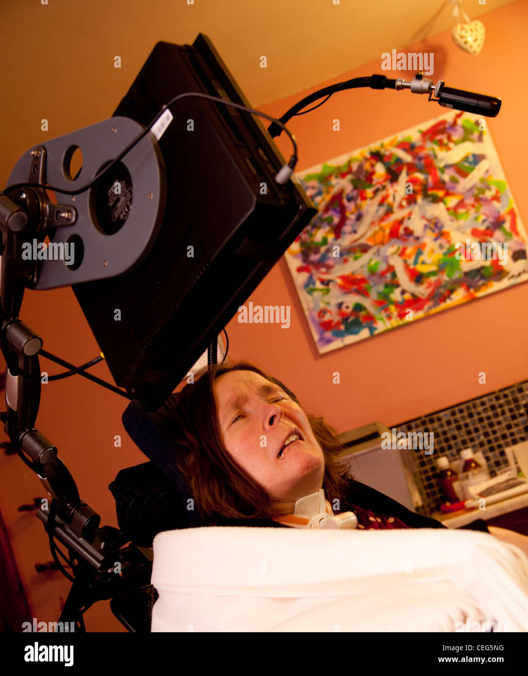 Woman Suffering From Locked In Syndrome High Resolution Stock ...