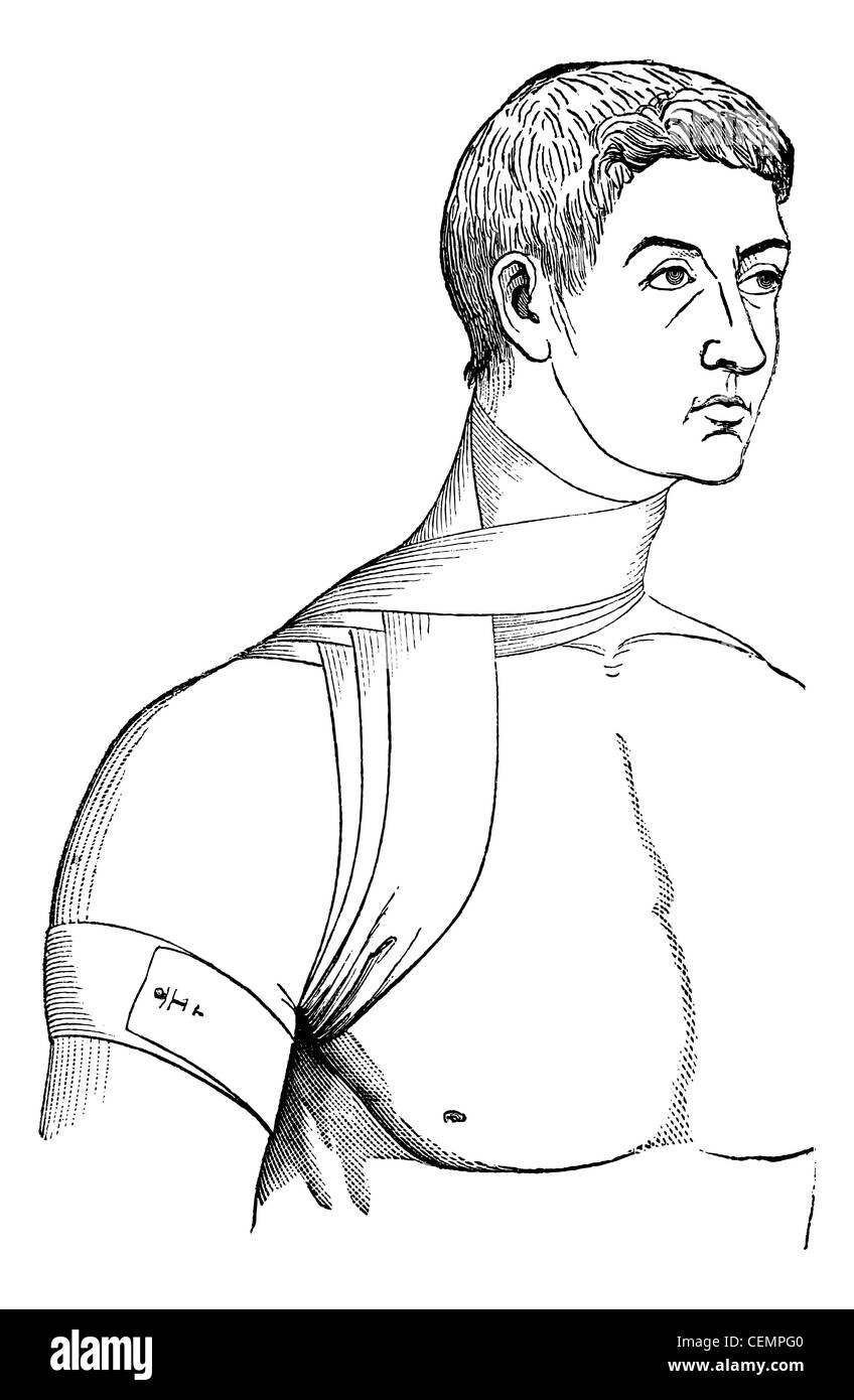 Bandage crosses the neck and armpit, vintage engraved illustration ...