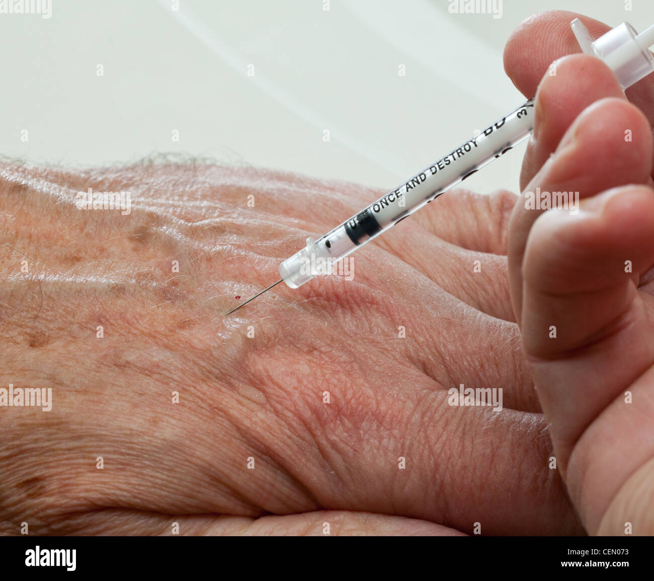 Injection into vein of senior man hand from small hypodermic needle ...