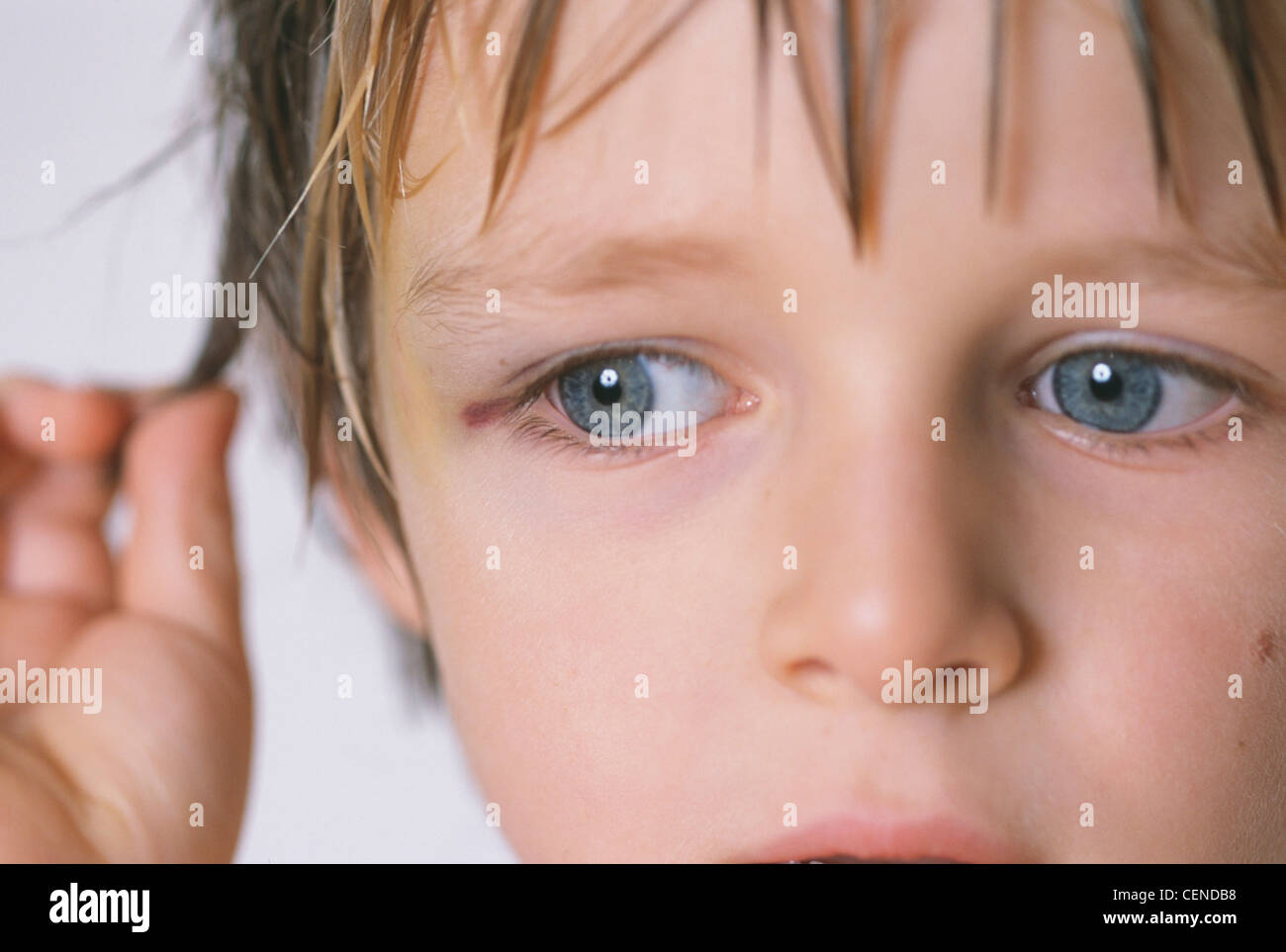 Close up of male child, years blonde wet hair, bruised eye looking to ...