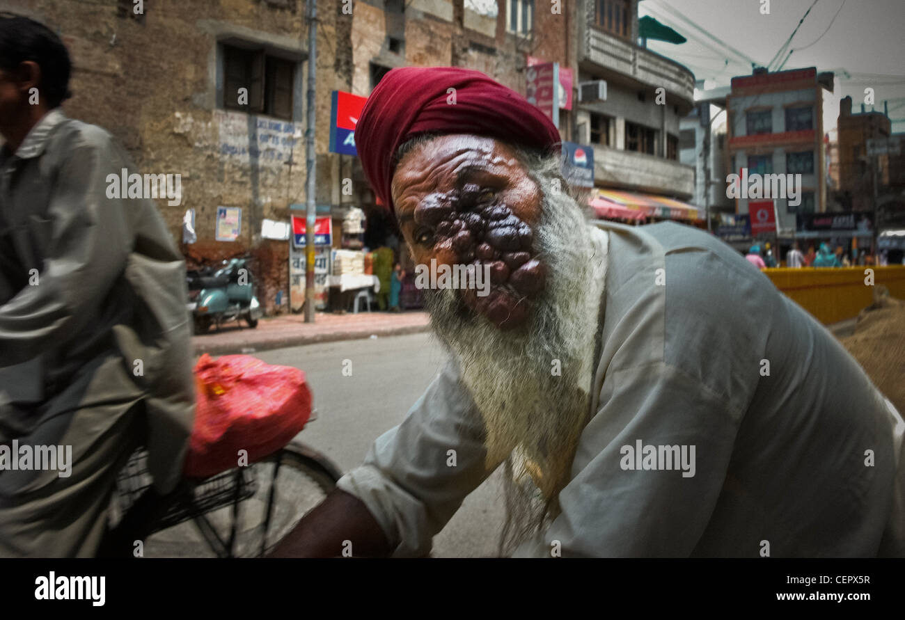 Amritsar, the Sikhs at the Golden Temple, The disabled, crossed the ...