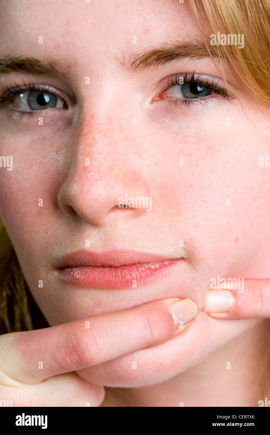 Female squeezing a spot Stock Photo - Alamy