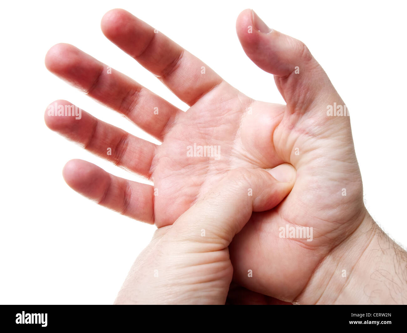 Palm acupressure treatment isolated on a white background Stock Photo ...