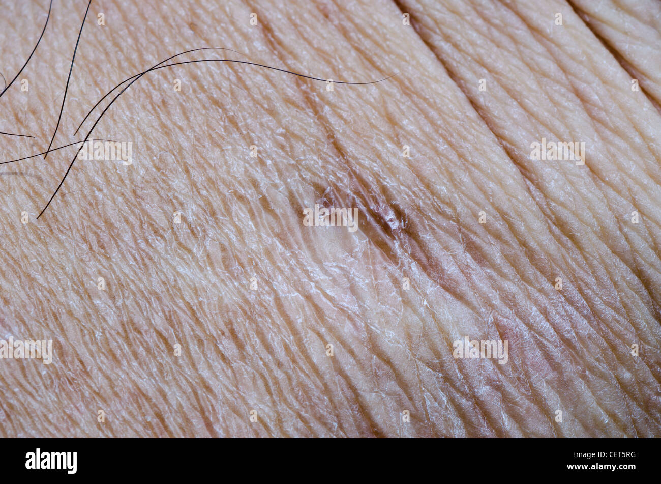 dry skin texture detail of human Stock Photo - Alamy