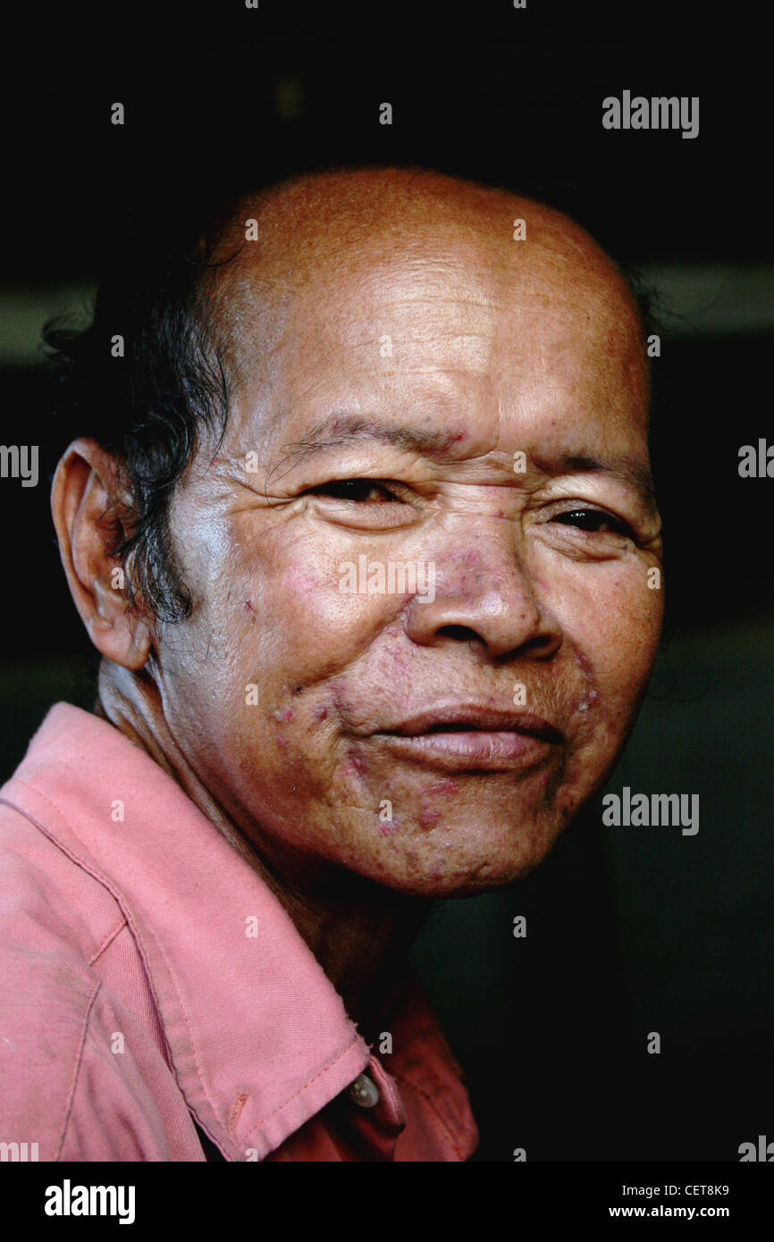 Hmong old man hi-res stock photography and images - Alamy