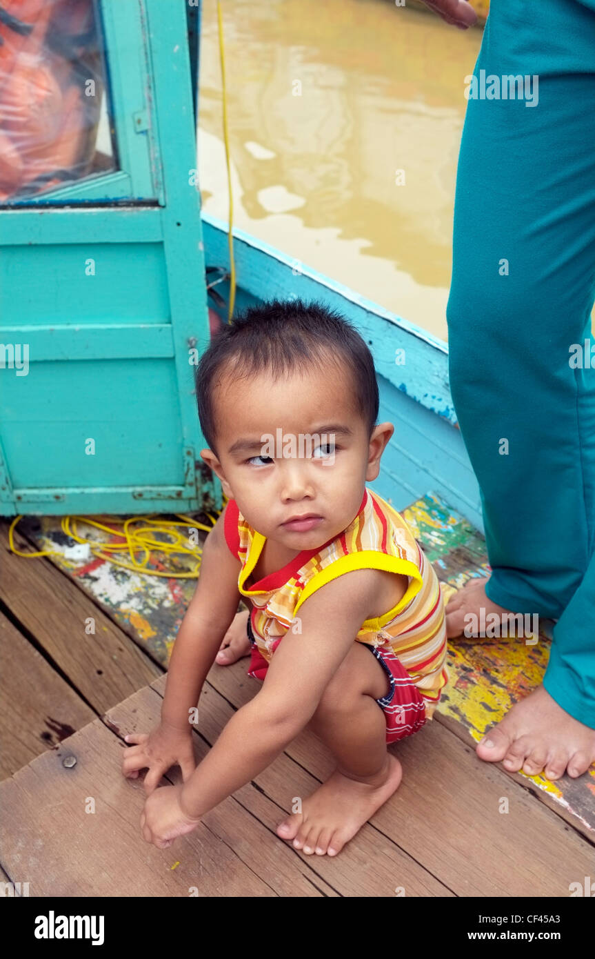 Congenital Malformation High Resolution Stock Photography and Images ...