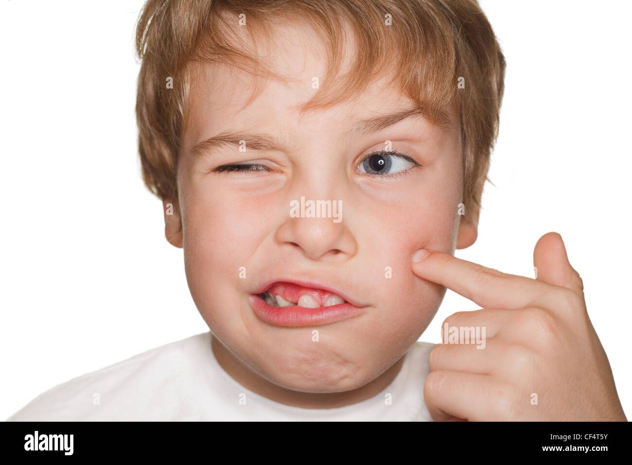 Small pimple hi-res stock photography and images - Alamy