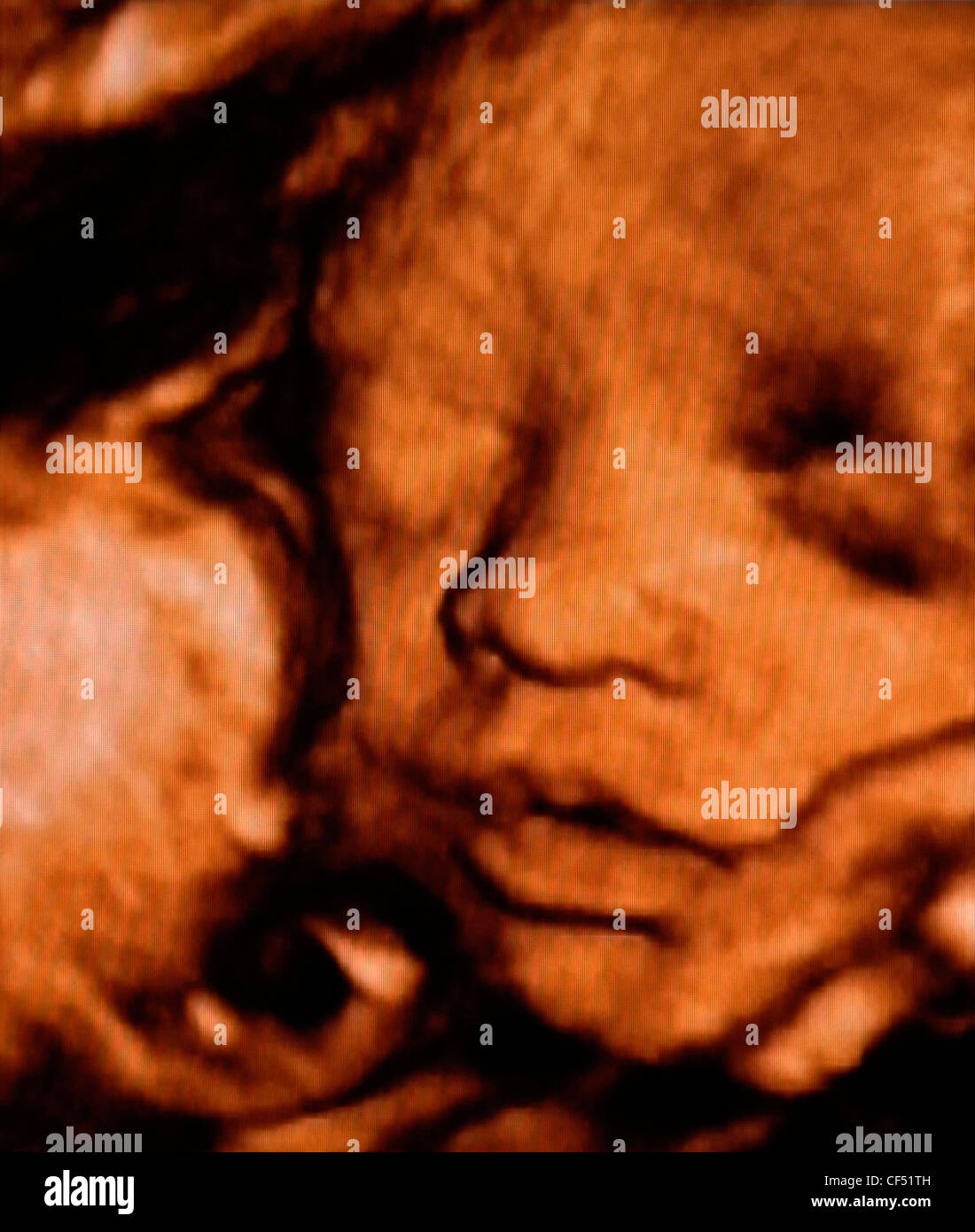 A 4D ultrasound scan of a foetus in the womb Stock Photo - Alamy