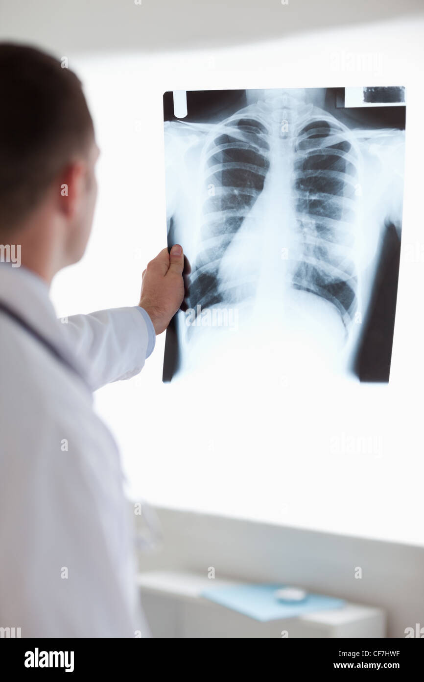 Close up of doctor holding x-ray against light Stock Photo - Alamy