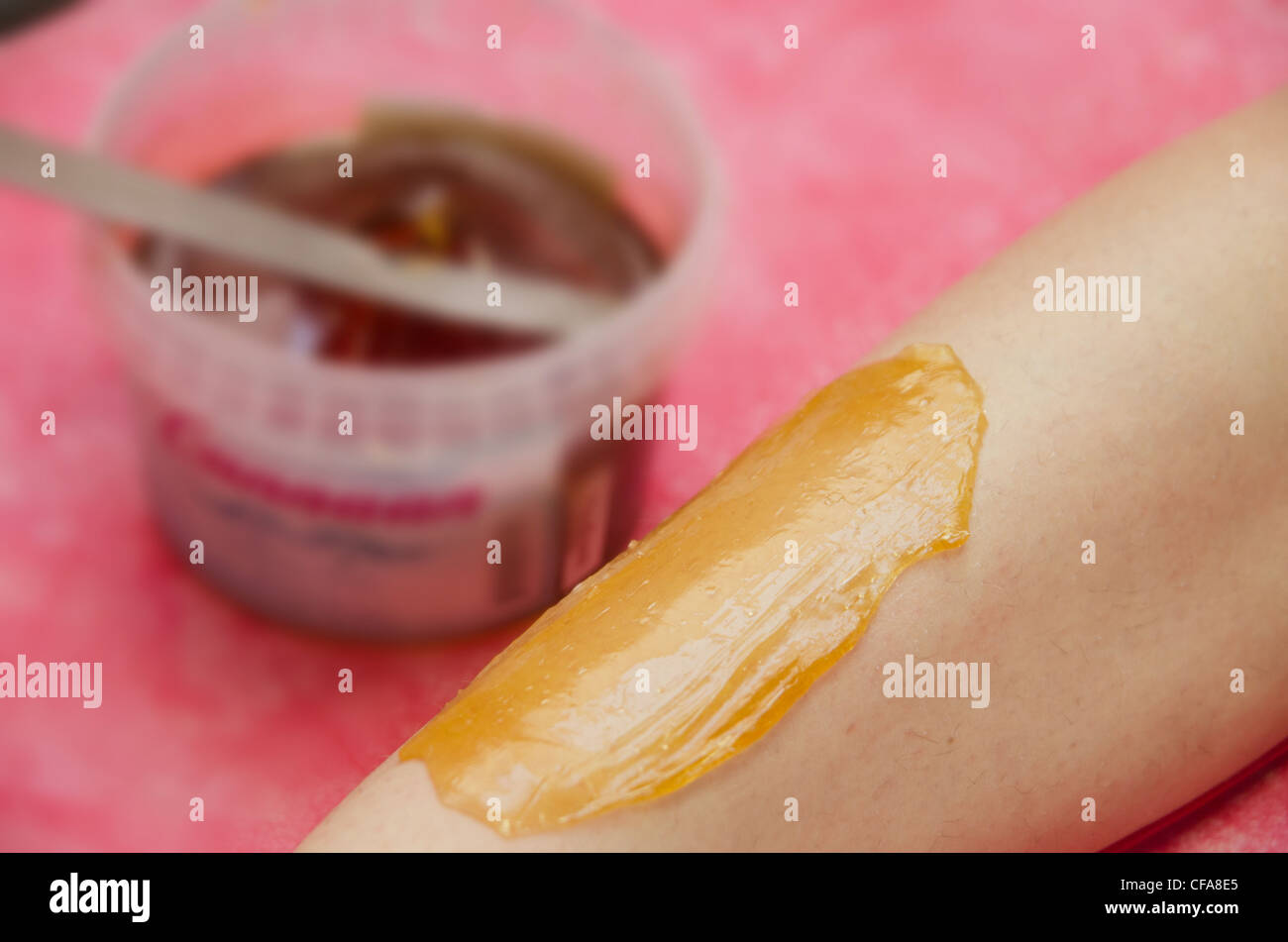 Sugaring: epilation with liquate sugar at legs. It is less painful hair ...