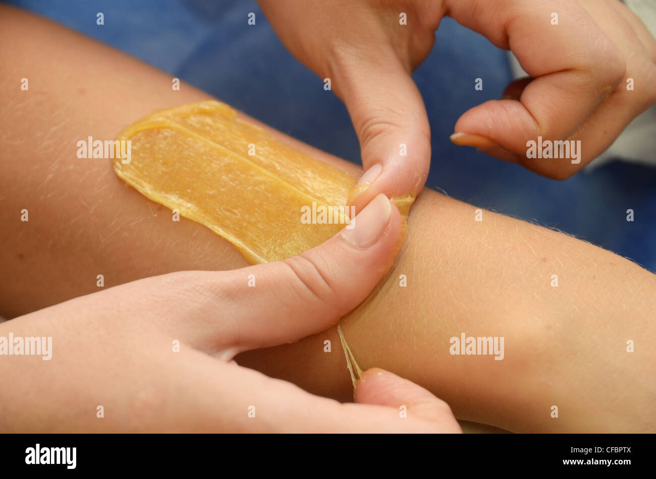 Epilation with liquate sugar at legs hi-res stock photography and ...