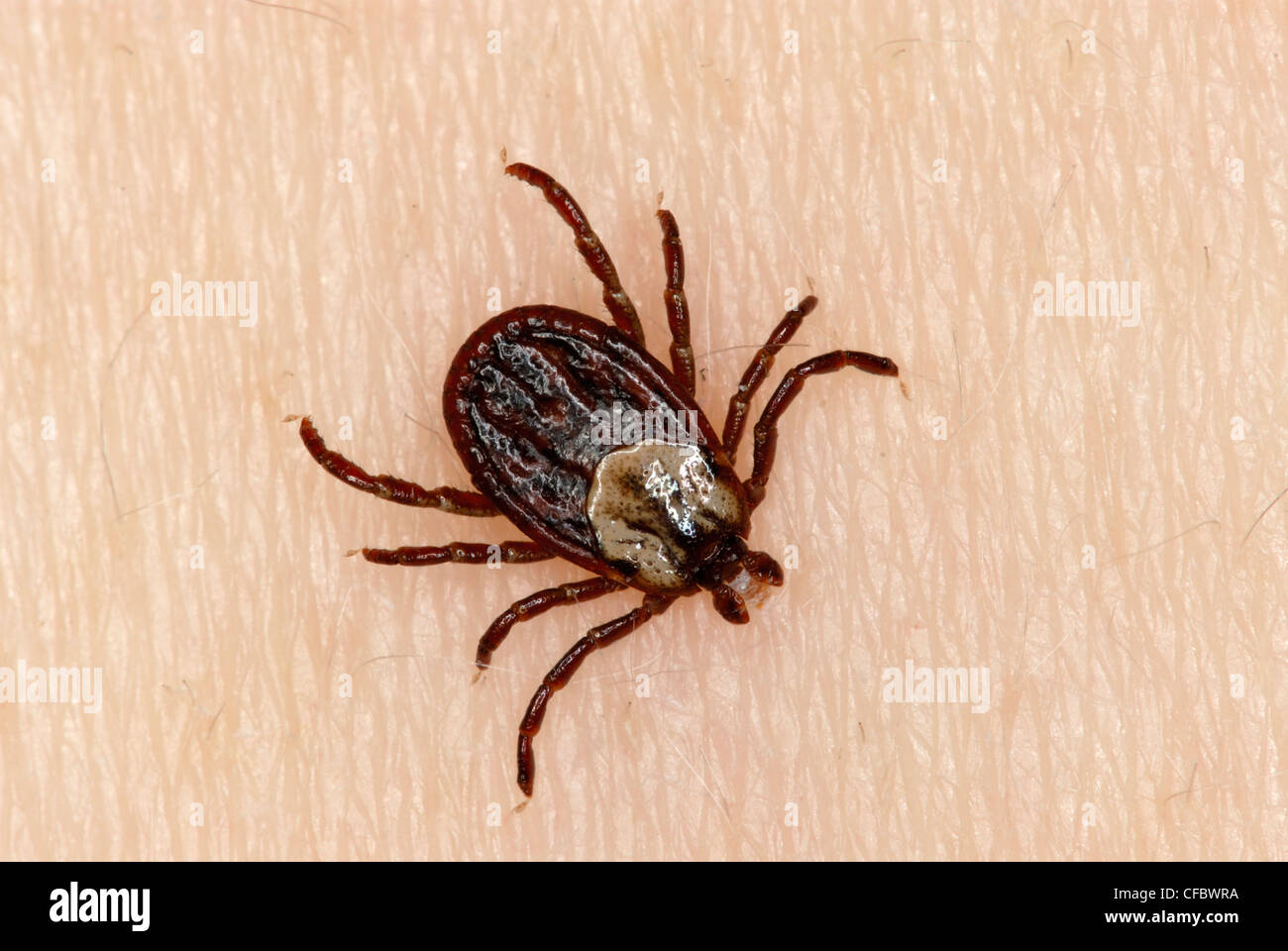 Wood Tick (Dermacentor variabilis) on person's skin, Ontario, Canada ...