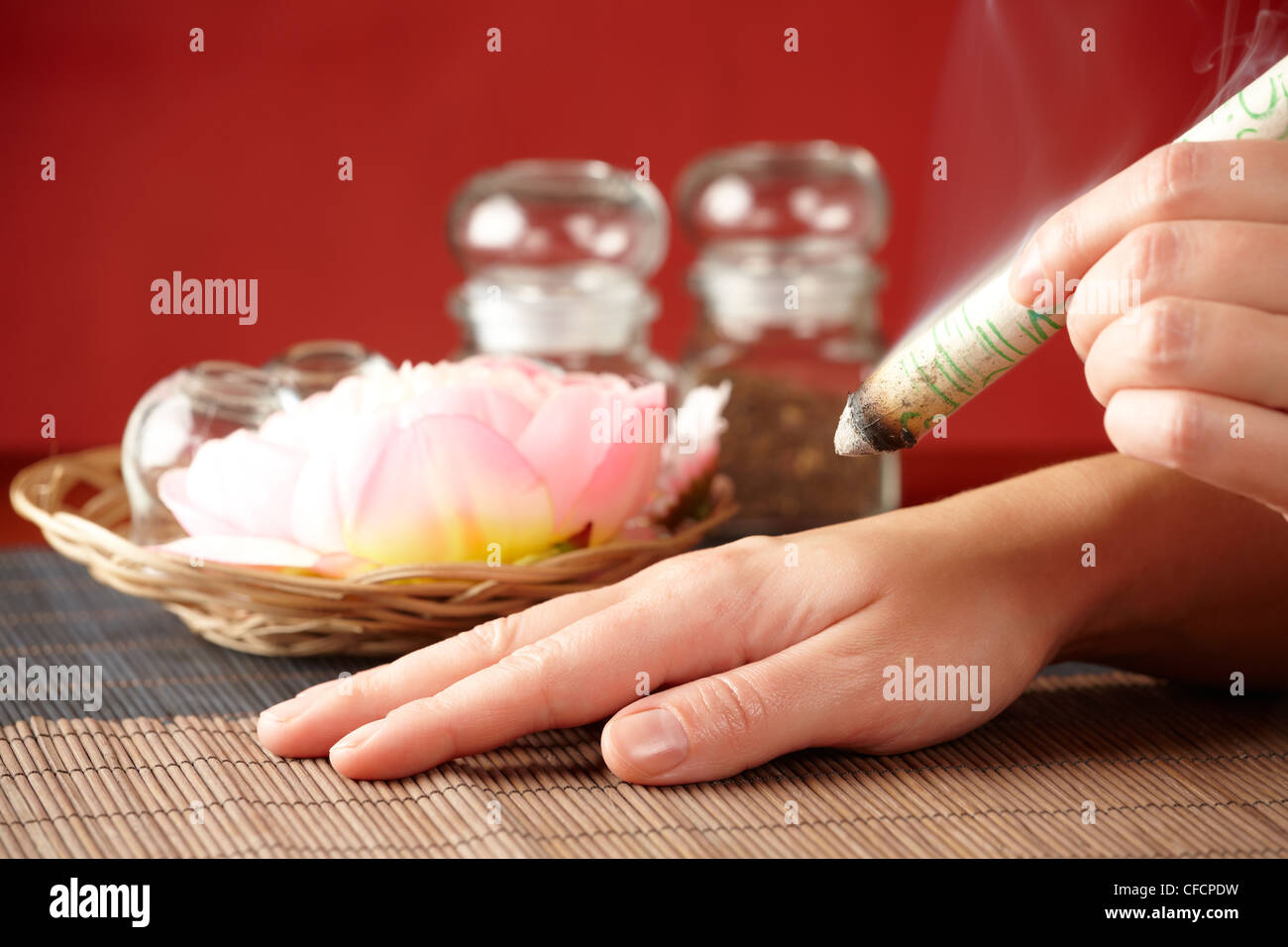 TCM Traditional Chinese Medicine. Hand applying moxa stick therapy ...