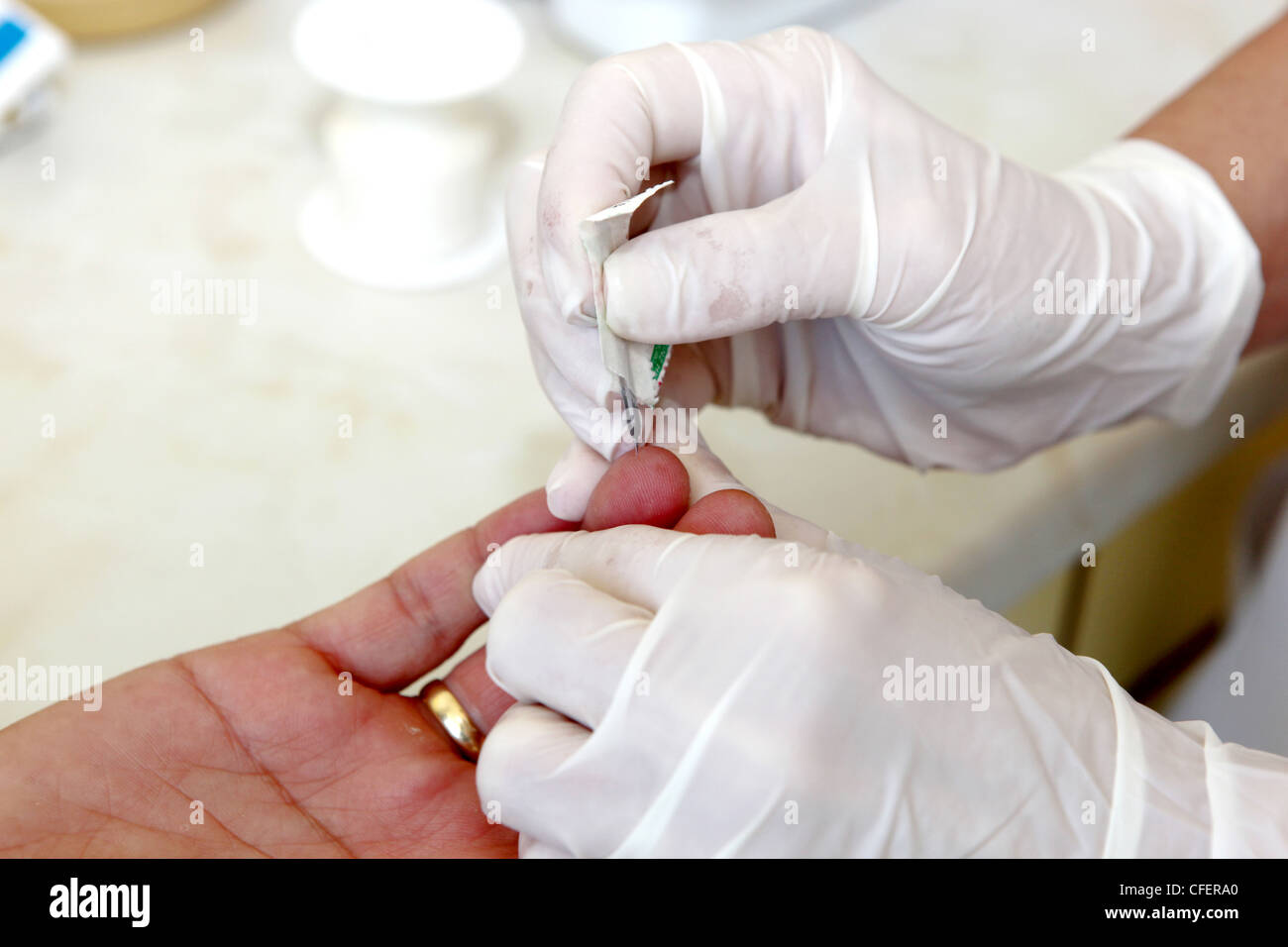Blood sample finger nhs hi-res stock photography and images - Alamy