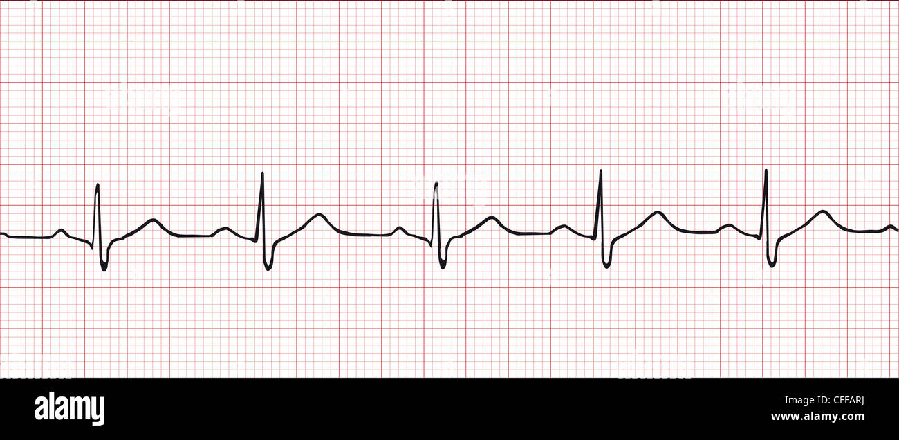 Normal electronic cardiogram vector illustration Stock Photo - Alamy