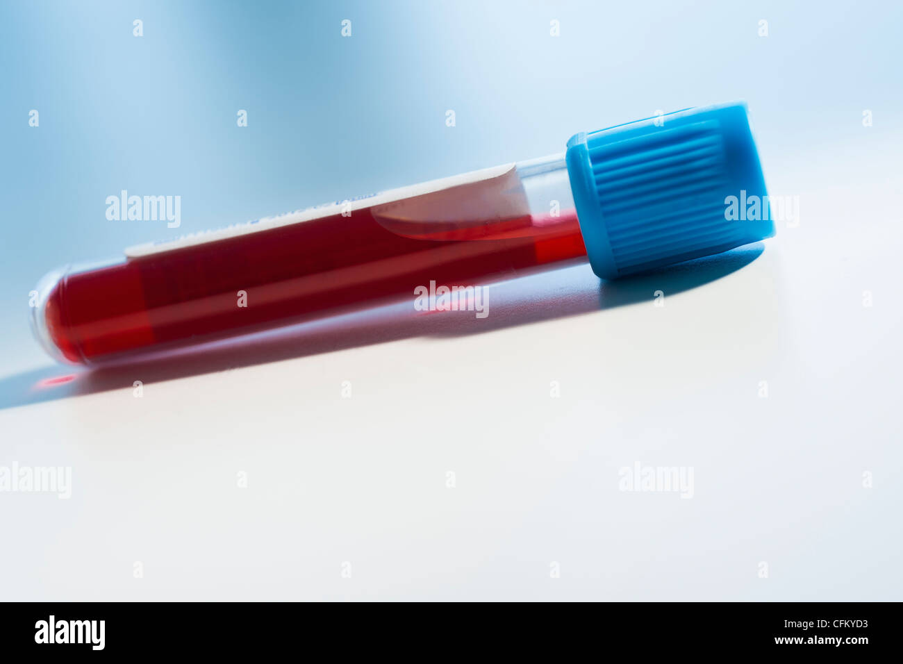 Blood vial hi-res stock photography and images - Alamy
