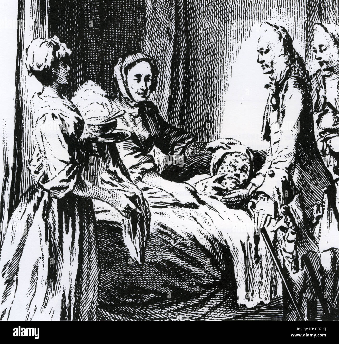 Smallpox hi-res stock photography and images - Alamy