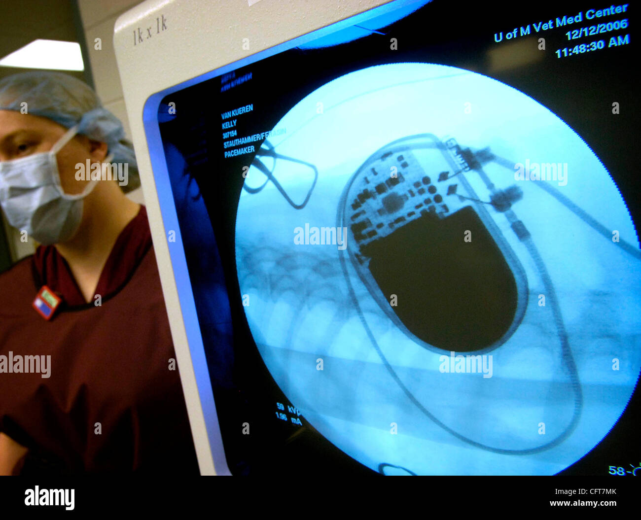 Medtronic pacemaker hi-res stock photography and images - Alamy
