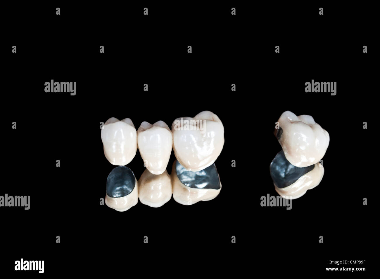 Ceramic dental crowns Stock Photo - Alamy