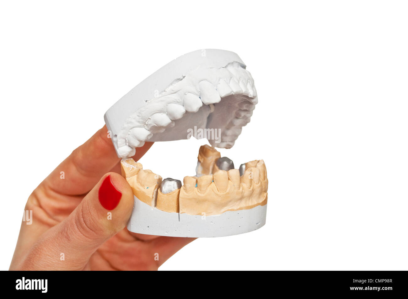 Dents model in dentists hands Stock Photo - Alamy