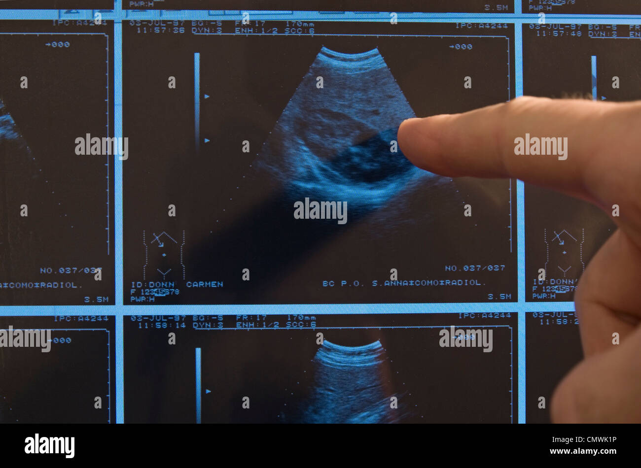 Ecography hi-res stock photography and images - Alamy