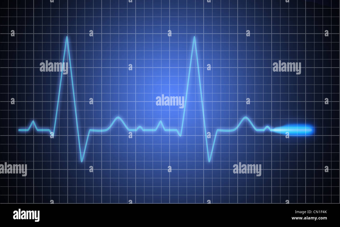 Medical heart monitor measuring heartbeat rate with blue background ...