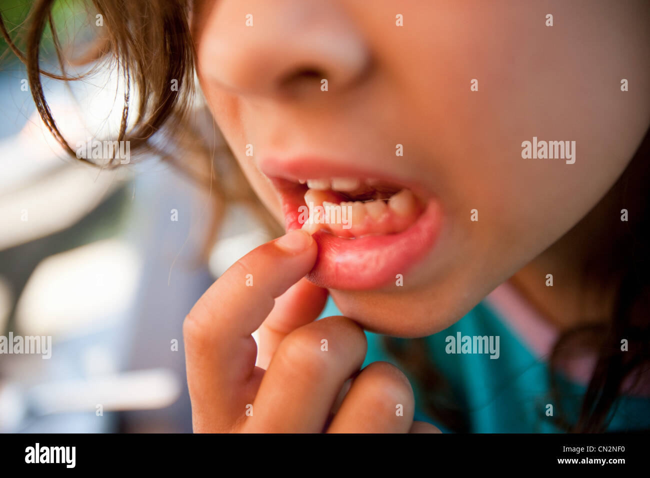 Girl touching loose tooth hi-res stock photography and images - Alamy