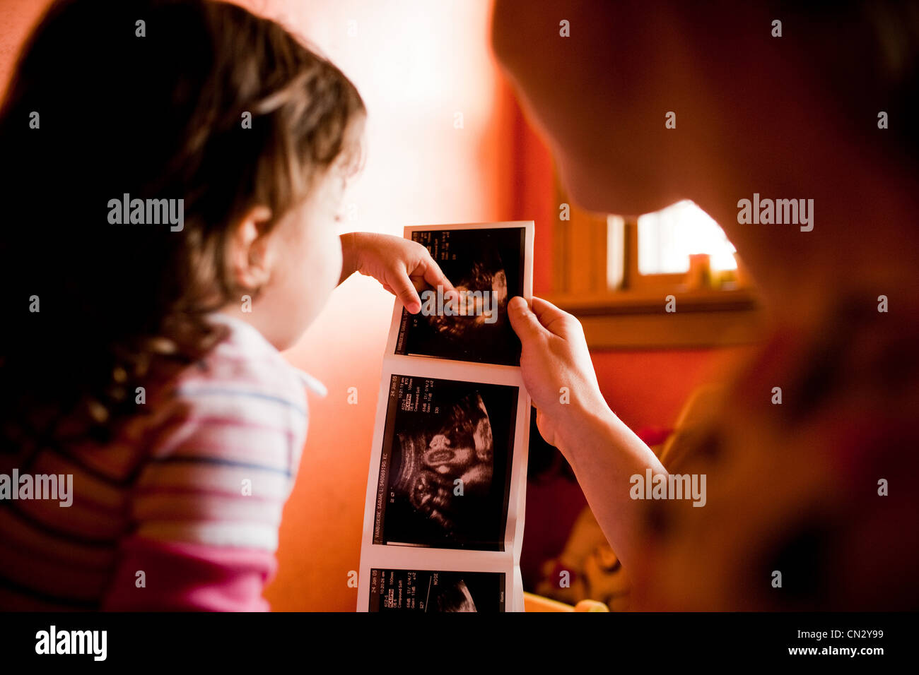 Baby scan hi-res stock photography and images - Alamy