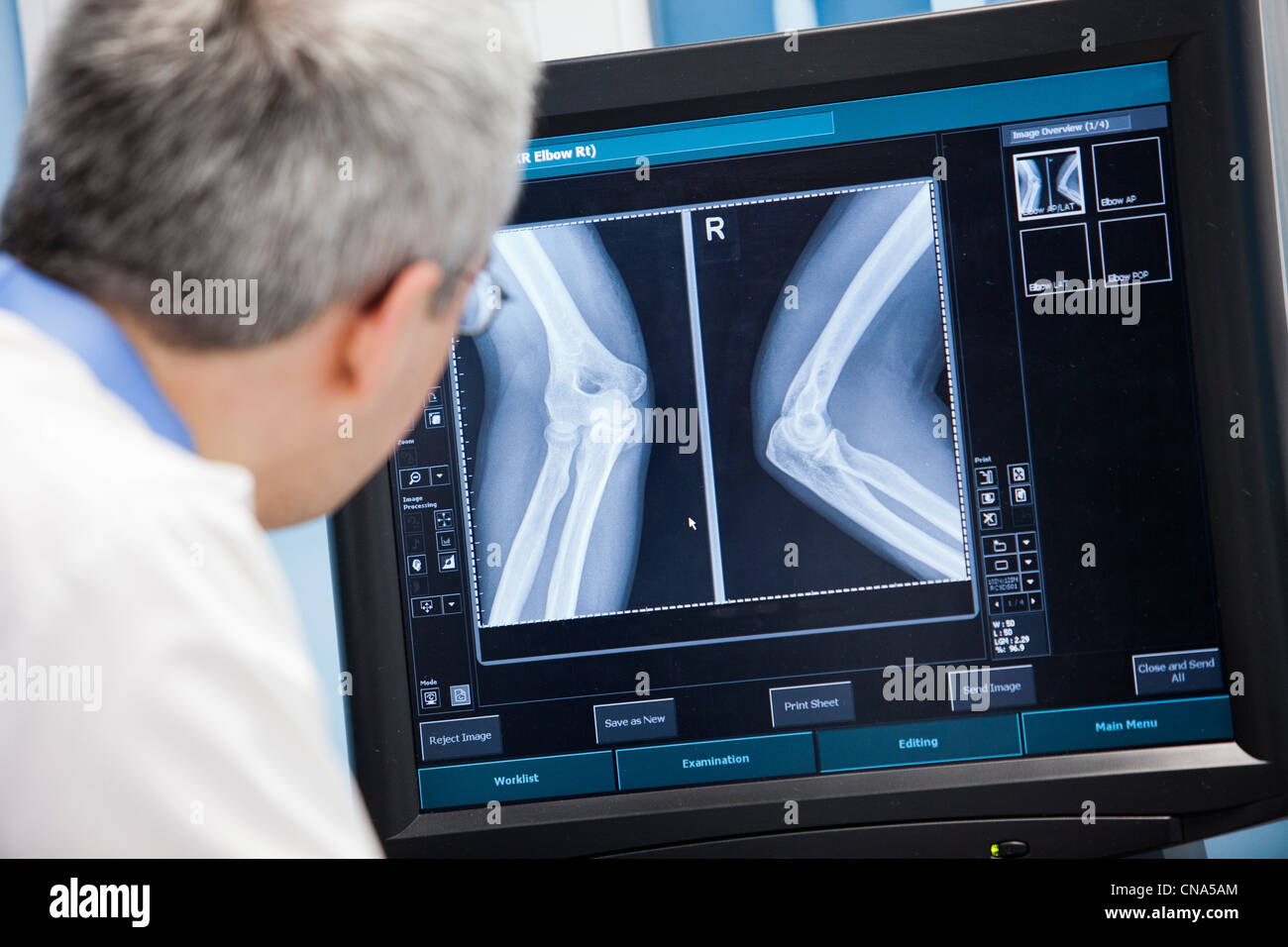Nhs mri hi-res stock photography and images - Alamy