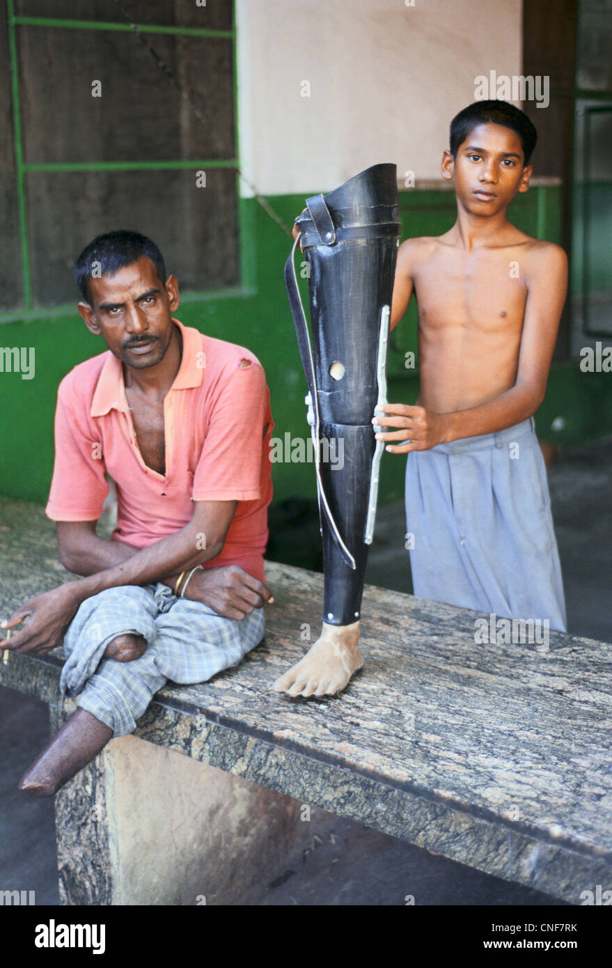 Amputee boy hi-res stock photography and images - Alamy