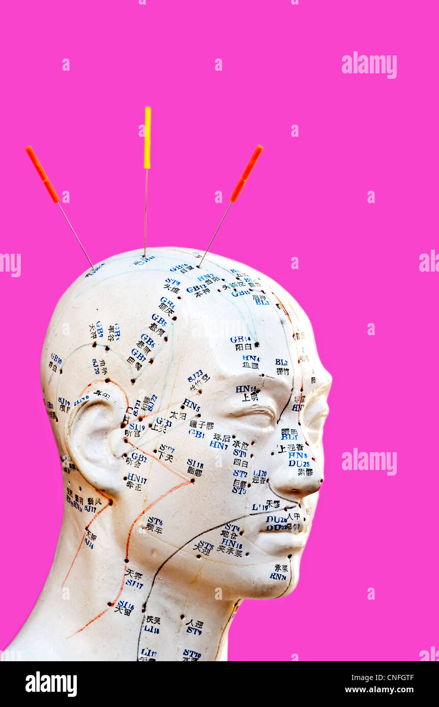 acupuncture head model with acupuncture needles Stock Photo - Alamy