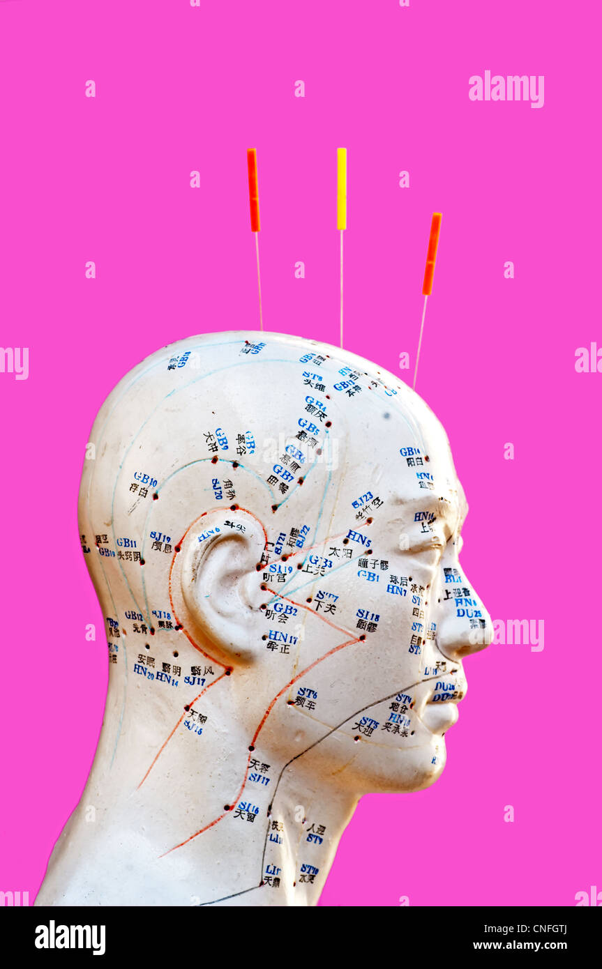 acupuncture head model with acupuncture needles Stock Photo - Alamy