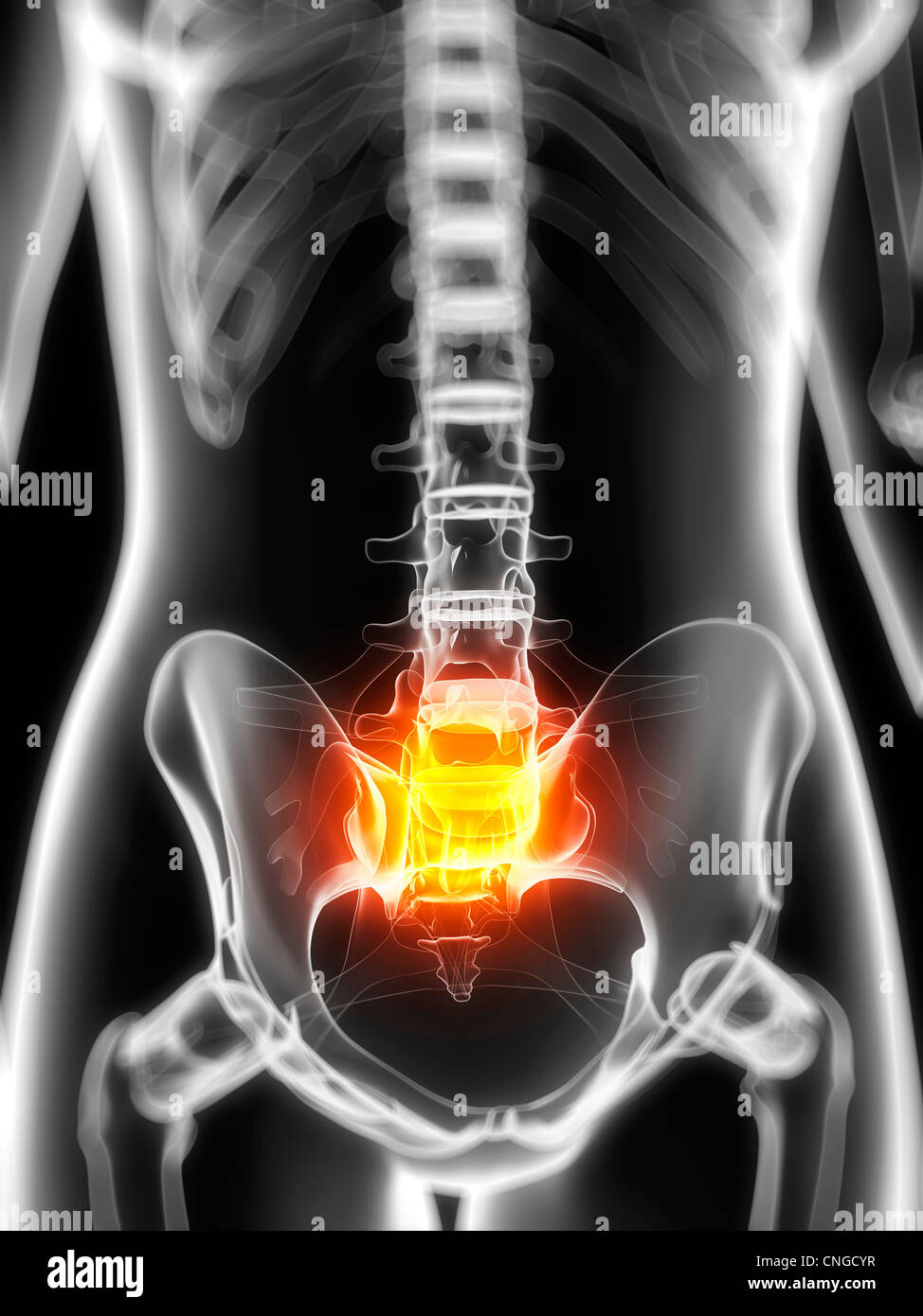 Back pain conceptual artwork Stock Photo - Alamy