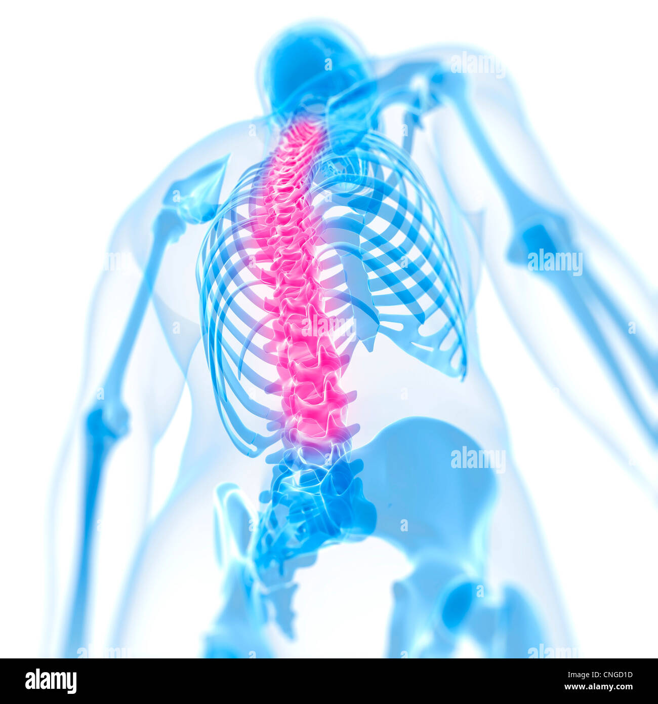 Back pain conceptual artwork Stock Photo - Alamy