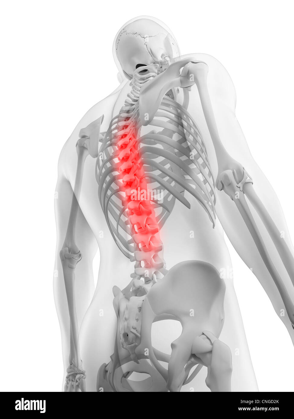 Back pain conceptual artwork Stock Photo - Alamy