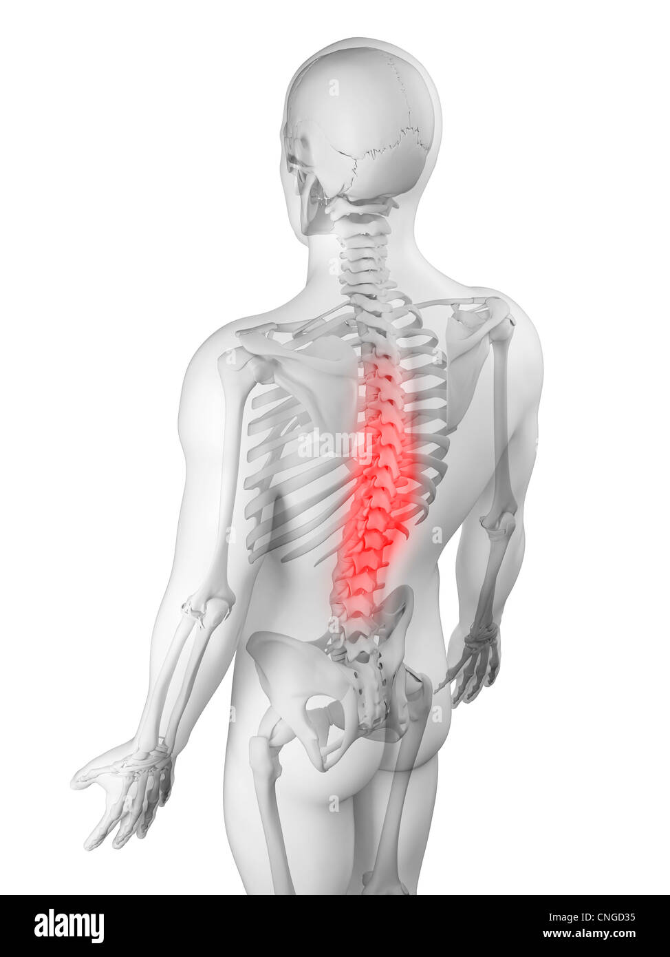 Back pain conceptual artwork Stock Photo - Alamy