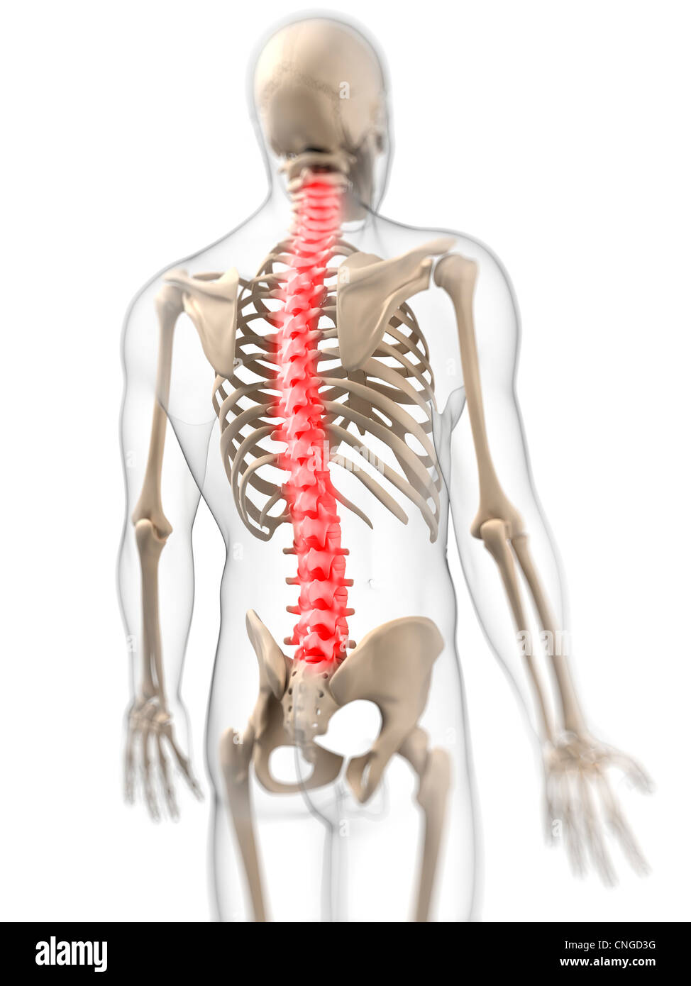 Back pain conceptual artwork Stock Photo - Alamy