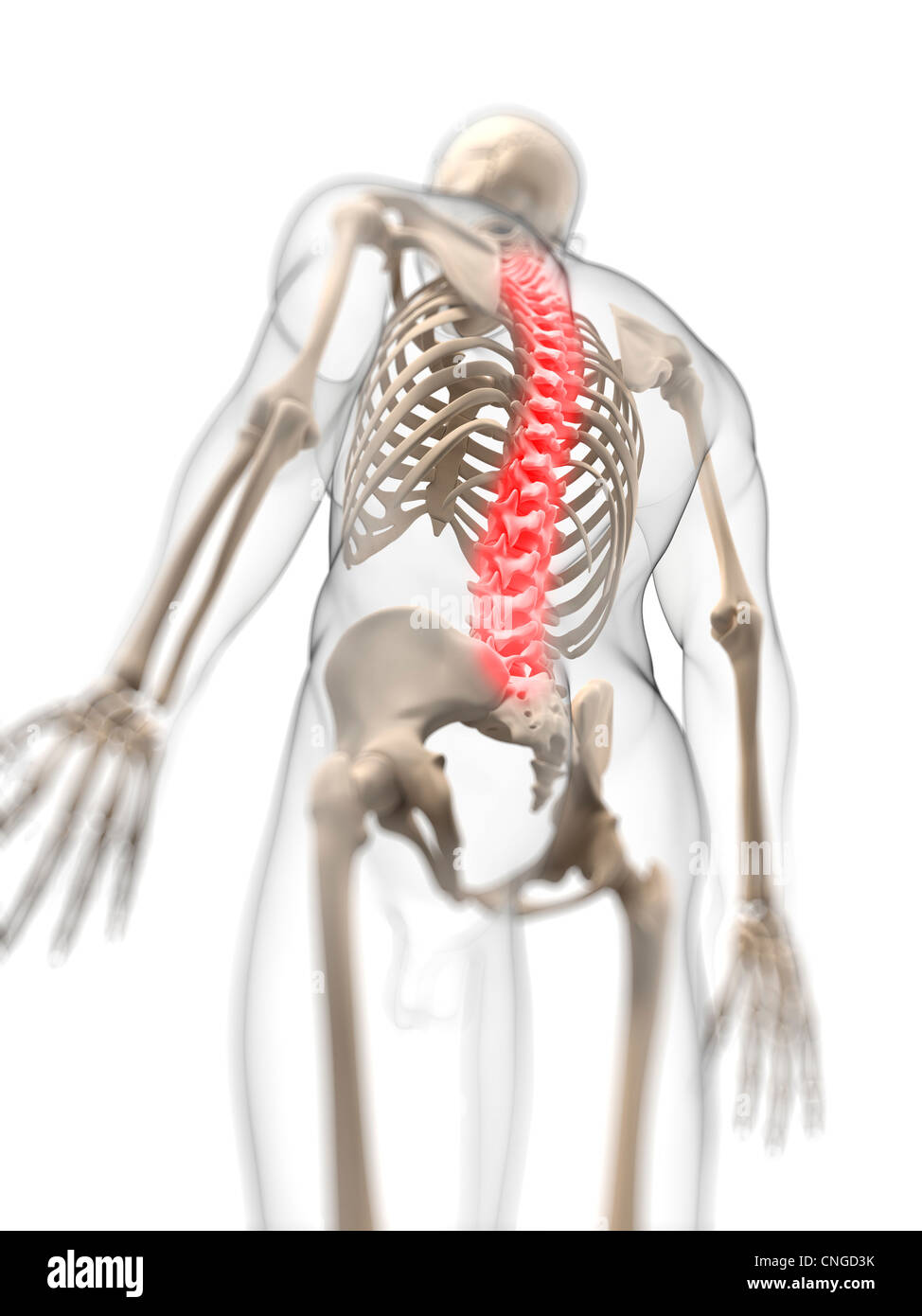 Back pain conceptual artwork Stock Photo - Alamy