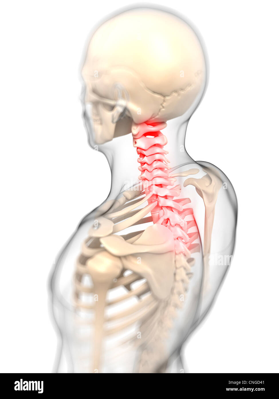 Back pain conceptual artwork Stock Photo - Alamy